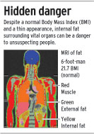 Thin people may be fat on the inside, doctors warn | News, Sports, Jobs ...